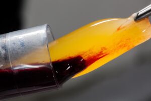 Membrana de PRF - Clinica Dr. Dal